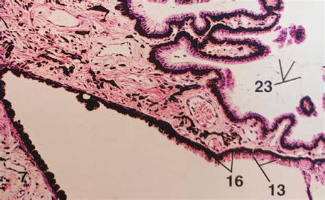 Diagram Of Ciliary Process Quizlet