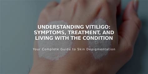 Understanding Vitiligo Symptoms Treatment And Living With The