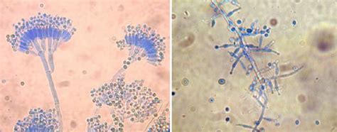 Penicillium Under Microscope