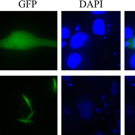 Subcellular Localization Of Fusion Protein Of Rrm1 Egfp In Sb Cells