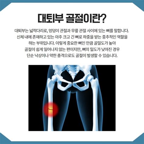 대퇴부골절 심각한 이유와 잘 치료하는 노하우 네이버 블로그