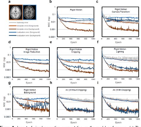 Brain Mri Segmentation Using Template Based Training And Visual