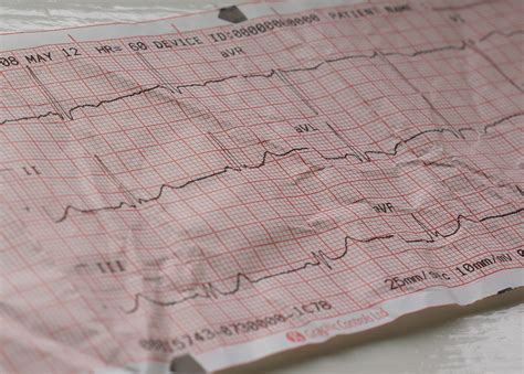 Decibels In Training The Online Peer Reviewed Publication For Medical Babes