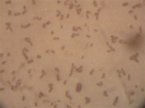The View Of Enterobacter Soli Sp Under The Microscope Download Scientific Diagram