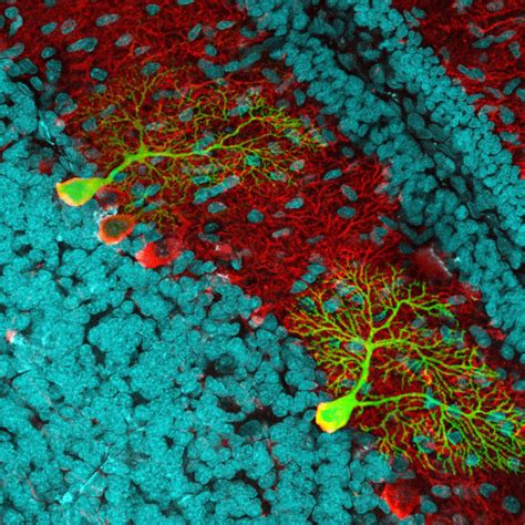 Sagittal Brain Slice Nikon Small World