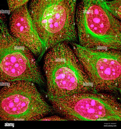 hela cells confocal light micrograph of hela cells the cell nuclei
