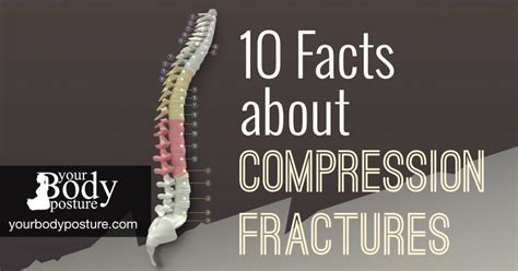 Facts About Compression Fractures Your Body Posture