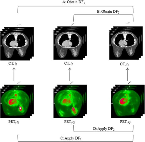 The Scheme For Applying The Algorithm To Register The Petct The Ct The Scheme For Applying The Algorithm To Register The Petct The Ct