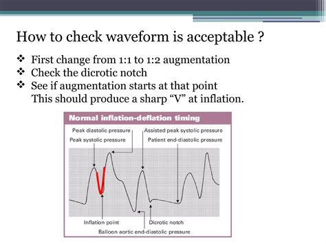 Intra Aortic Ballon Pump Iabp Ppt