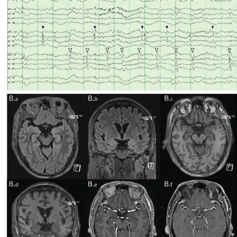 EEG And Brain Imaging Download Scientific Diagram