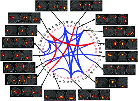 Functional Connectivity Analysis Result For First 10 Seconds Download Scientific Diagram