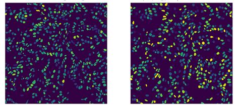 How To Interpret Stardistmatching Results Usage And Issues Imagesc Forum