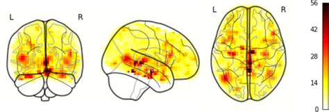 Deep Labeling Of Fmri Brain Networks Paper And Code Catalyzex