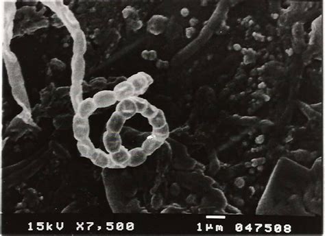 Scanning Electron Micrograph Showing The Growth Of S Ruber After 7 Download Scientific Diagram