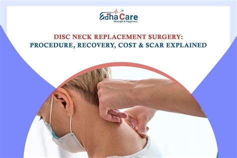 Disc Neck Replacement Surgery Procedure Recovery And Cost