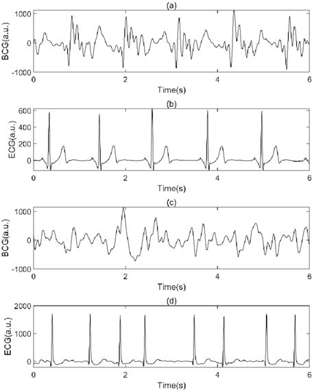 examples of bcg signal and synchronized ecg a u arbitrary units