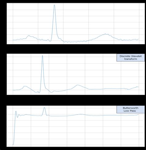 Ecg Wave Before And After Filtering Download Scientific Diagram