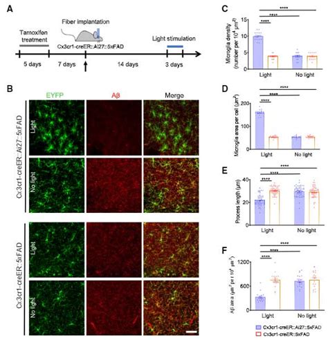 ミクログリアの活性化と補体の抑制でアルツハイマー病を治療