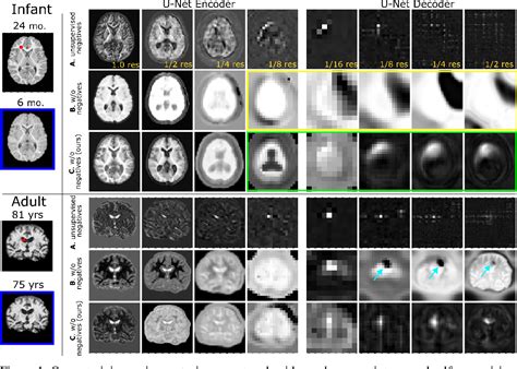 Figure 2 From Local Spatiotemporal Representation Learning For Longitudinally Consistent
