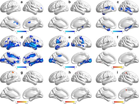 A Regions That Showed Seed Based Functional Connectivity Between Group