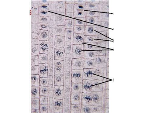 Mitosis Microscope Slide Quiz