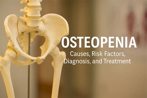 Osteopenia Causes Diagnosis And Functional Medicine Solutions Revolution Health And Wellness