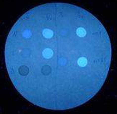 An Example Of Beutlers” Fluorescent Spot Test Samples With Enzyme Download Scientific