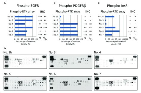 Comparison Of Immunohistochemical And Phospho Protein Array Analysis Download Scientific