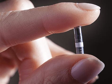 Blood Glucose Implant Sensor At Doris Sims Blog Blood Glucose Implant Sensor At Doris Sims Blog