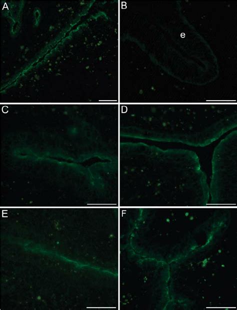 Light Micrographs Demonstrating Aqp5 Staining Of The Rat Uterus From