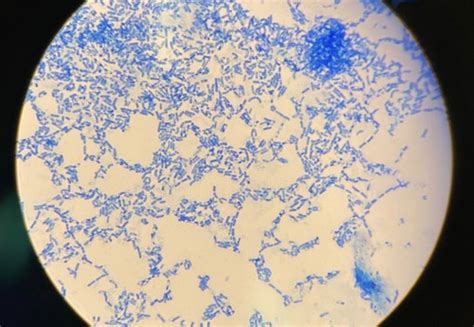 Simple Stain Staphylococcus Aureus