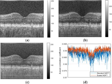 Figure 1 From Generalized Image Reconstruction In Optical Coherence Tomography Using Redundant