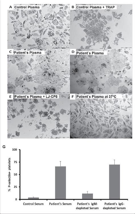 Electron Microscopy Evaluation And Assessment Of P Selectin Of Donor