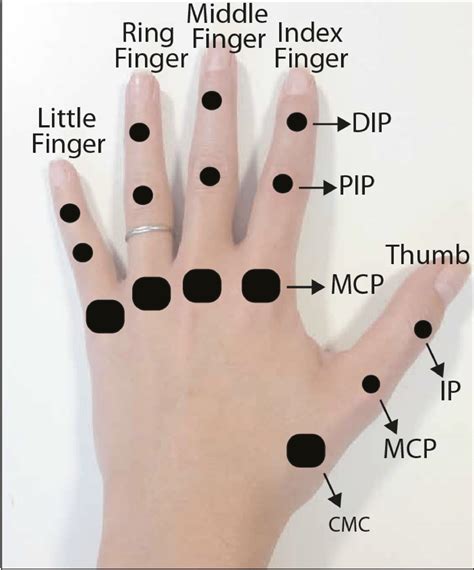 Pad Of Finger Medical Term At Sandra Moody Blog
