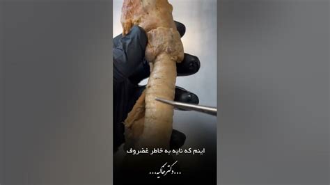 بررسی ساختار نای و مری و حنجره Youtube