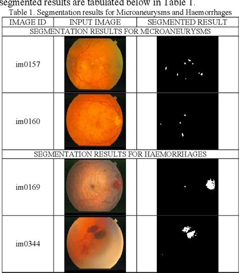 Figure 1 From Segmentation Of Lesions From Fundus Images To Grade The
