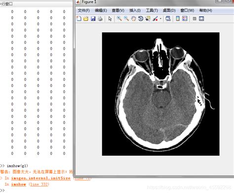 Stretchlim函数stretchlim函数的用法 Csdn博客