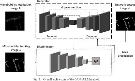 Figure 1 From Generative Adversarial Nets For Ultrafast Ultrasound Localization Microscopy