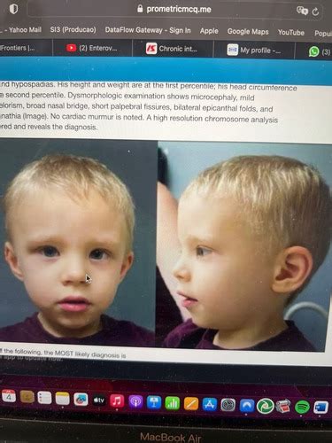 Genetic Flashcards Quizlet