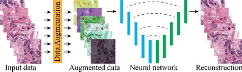 Quantifying The Effects Of Data Augmentation And Stain Color Normalization In Convolutional