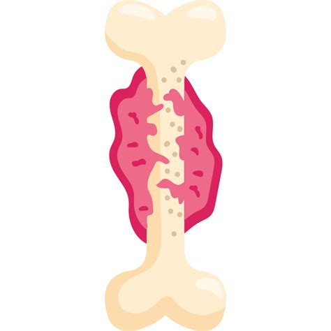 Sarcoma Bone Cancer Awareness 55784224 Png