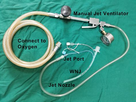Supraglottic Jet Oxygenation And Ventilation Using A Wei Nasal Jet Tube