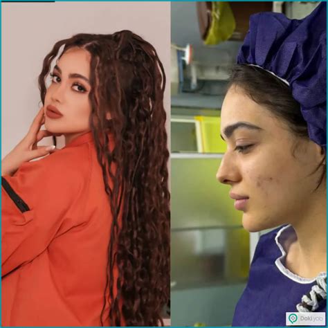 دکتر کامبیز پوریوسف جراح بینی تهران؛ هزینه نمونه کار