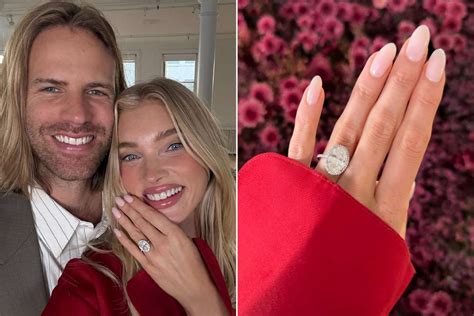 Elsa Hosk And Tom Daly Are Engaged
