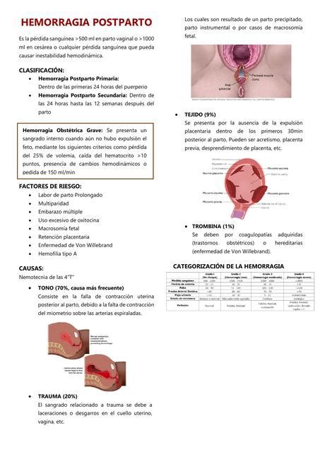 Hemorragia Postparto Camila Requena Udocz