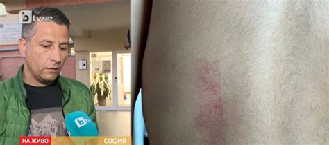 4 годишно момиченце се прибра посинено от детската градина