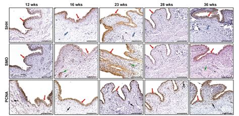 Figure 1 From Spatiotemporal Expression Of Shh Gli Signaling In Human Fetal Bladder Development