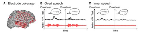 Figure 1 From Decoding Inner Speech Using Electrocorticography