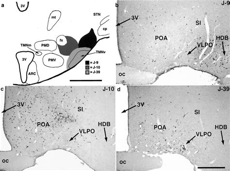 Innervation Of Histaminergic Tuberomammillary Neurons By Gabaergic And