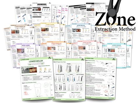 Zone Extraction Method Surgical Master
